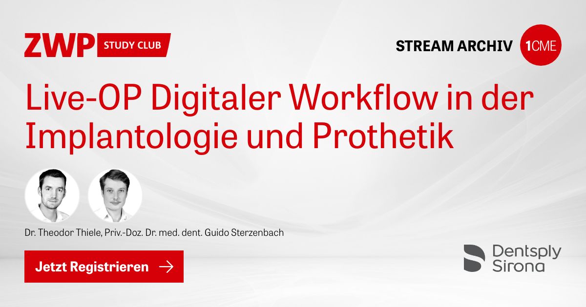 Live-OP Digitaler Workflow in der Implantologie und Prothetik - Webinar - ZWP Study Club