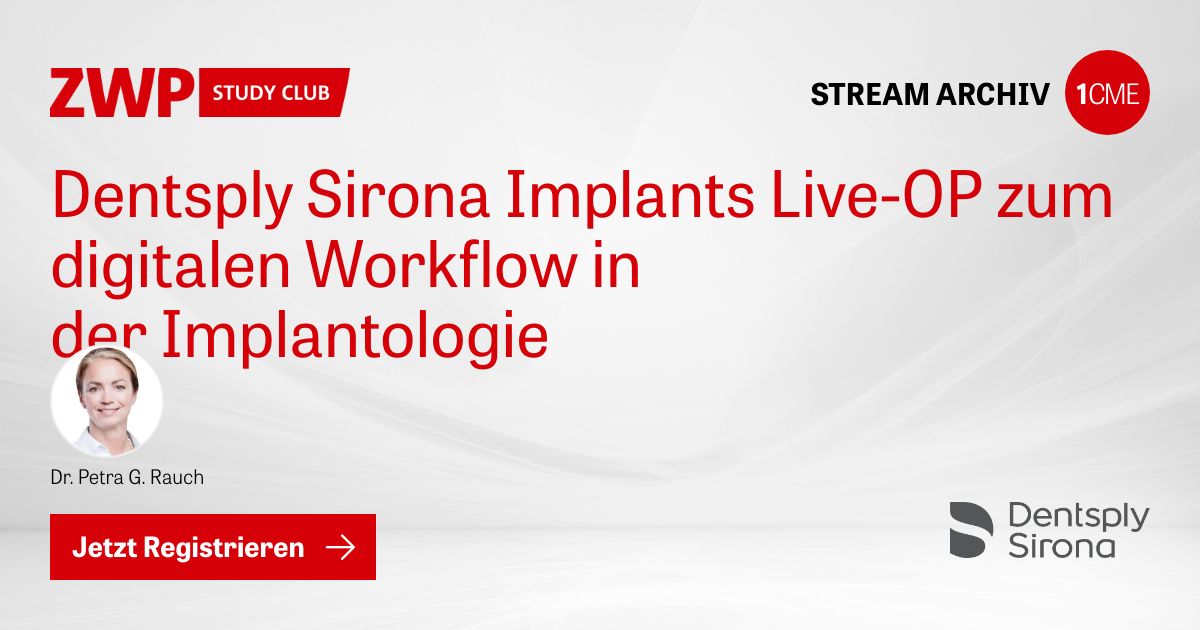 Dentsply Sirona Implants Live-OP zum digitalen Workflow in der Implantologie - Webinar - ZWP ...