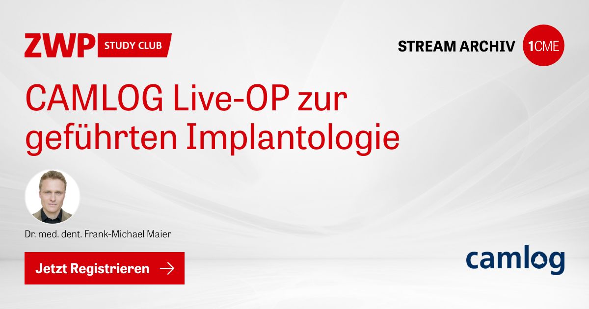 CAMLOG Live-OP zur geführten Implantologie - Webinar - ZWP Study Club